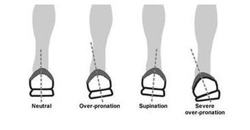 What is Over Supination