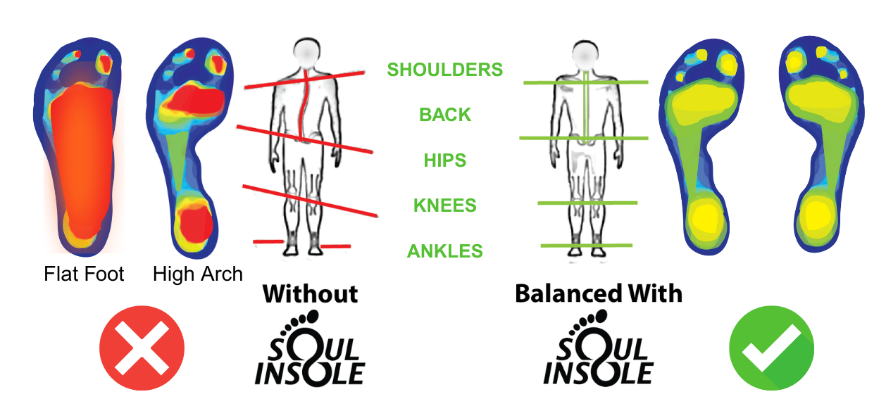 Soul Insole | Best Running Insoles | Plantar Fasciitis X